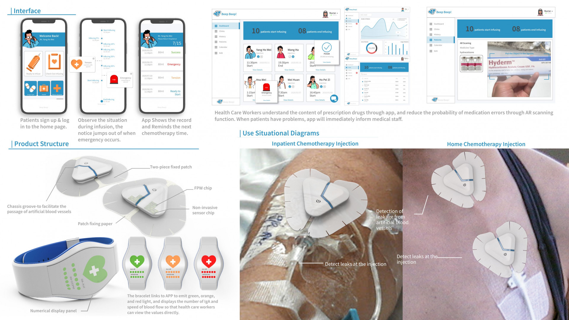 Beep Beep! Venous Infusion Leak Detector