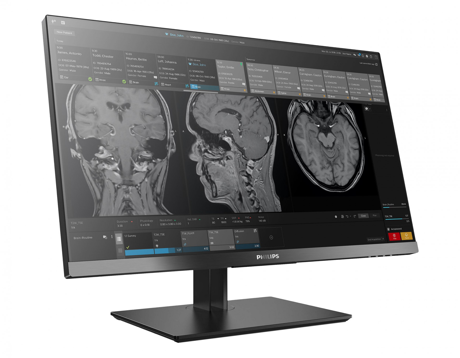 Philips MR Workspace