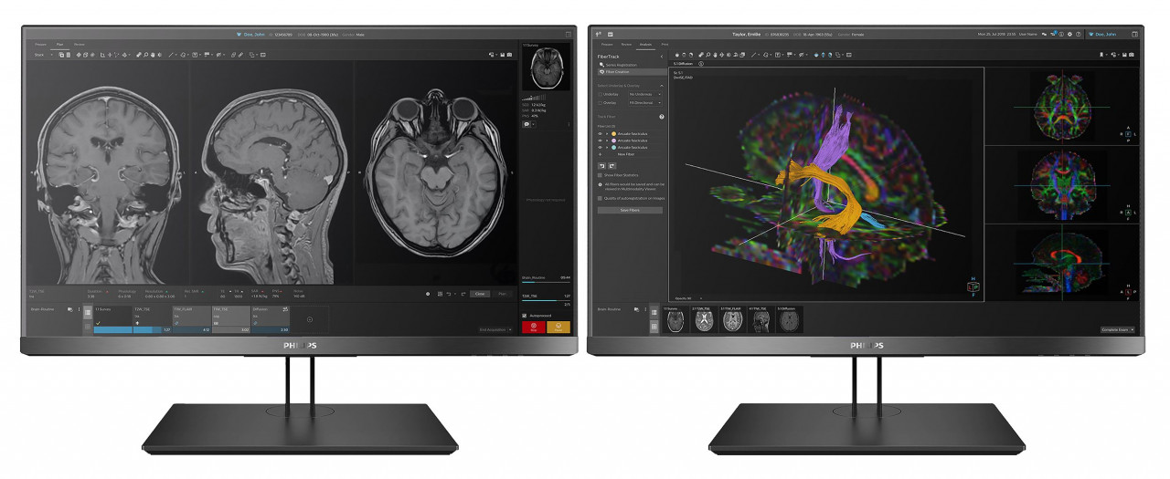 Philips MR Workspace